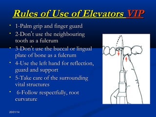 Rules of using dental forceps & elevator | PPT
