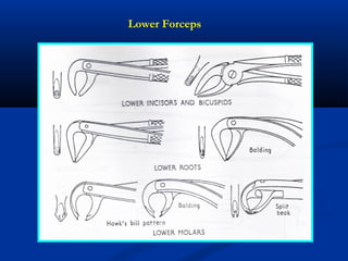 Dental Forceps Chart
