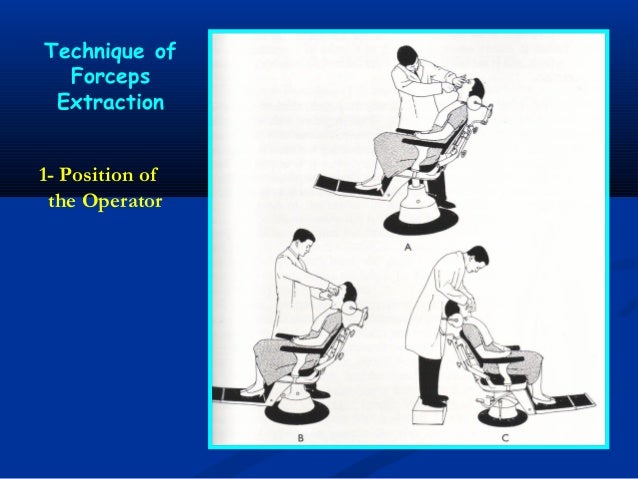 Rules of using dental forceps & elevator
