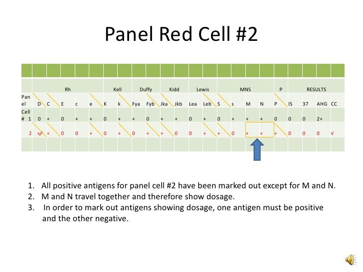 Ruling out using abid panel