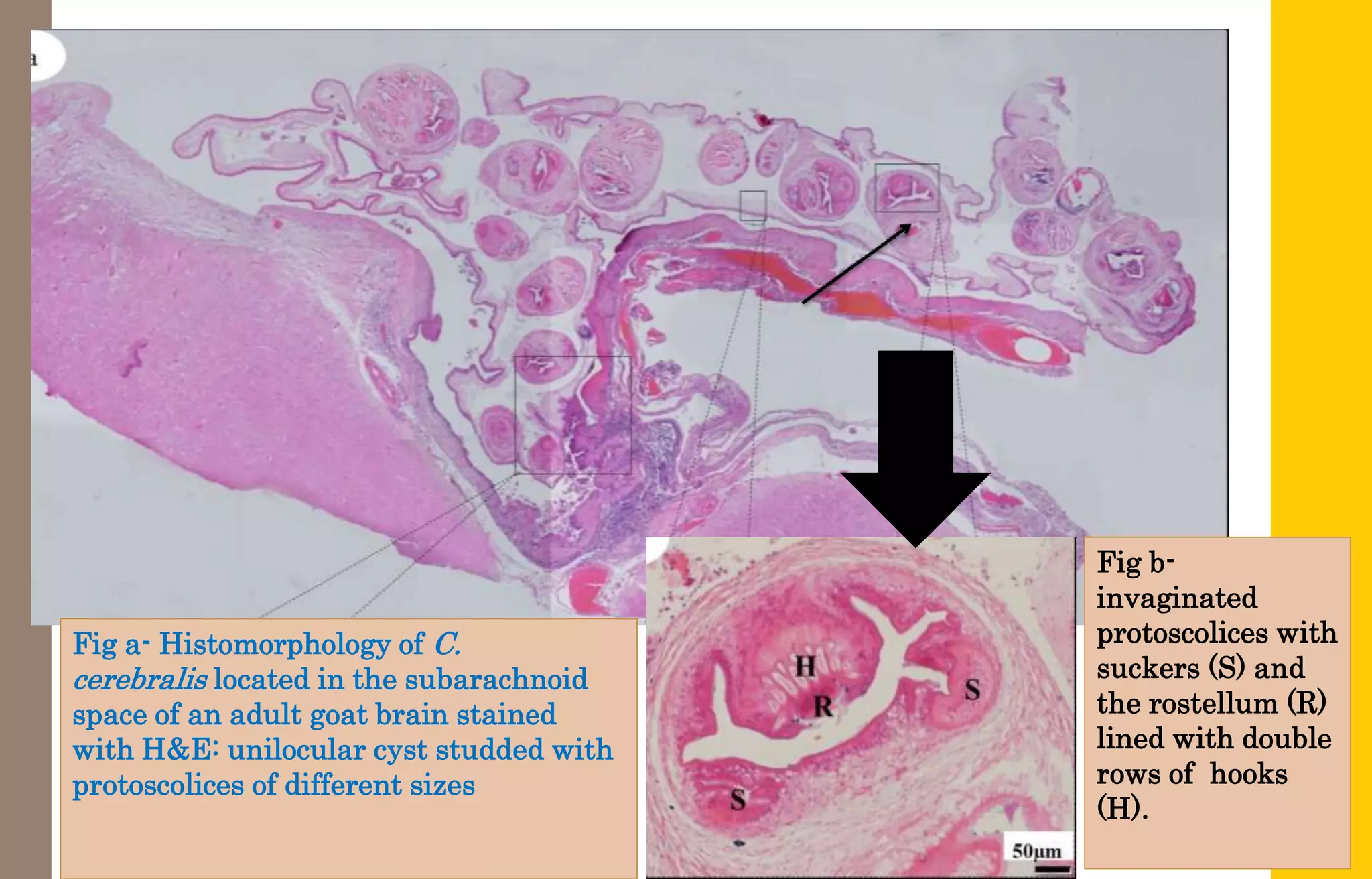 Ruminants tapeworm.pptx