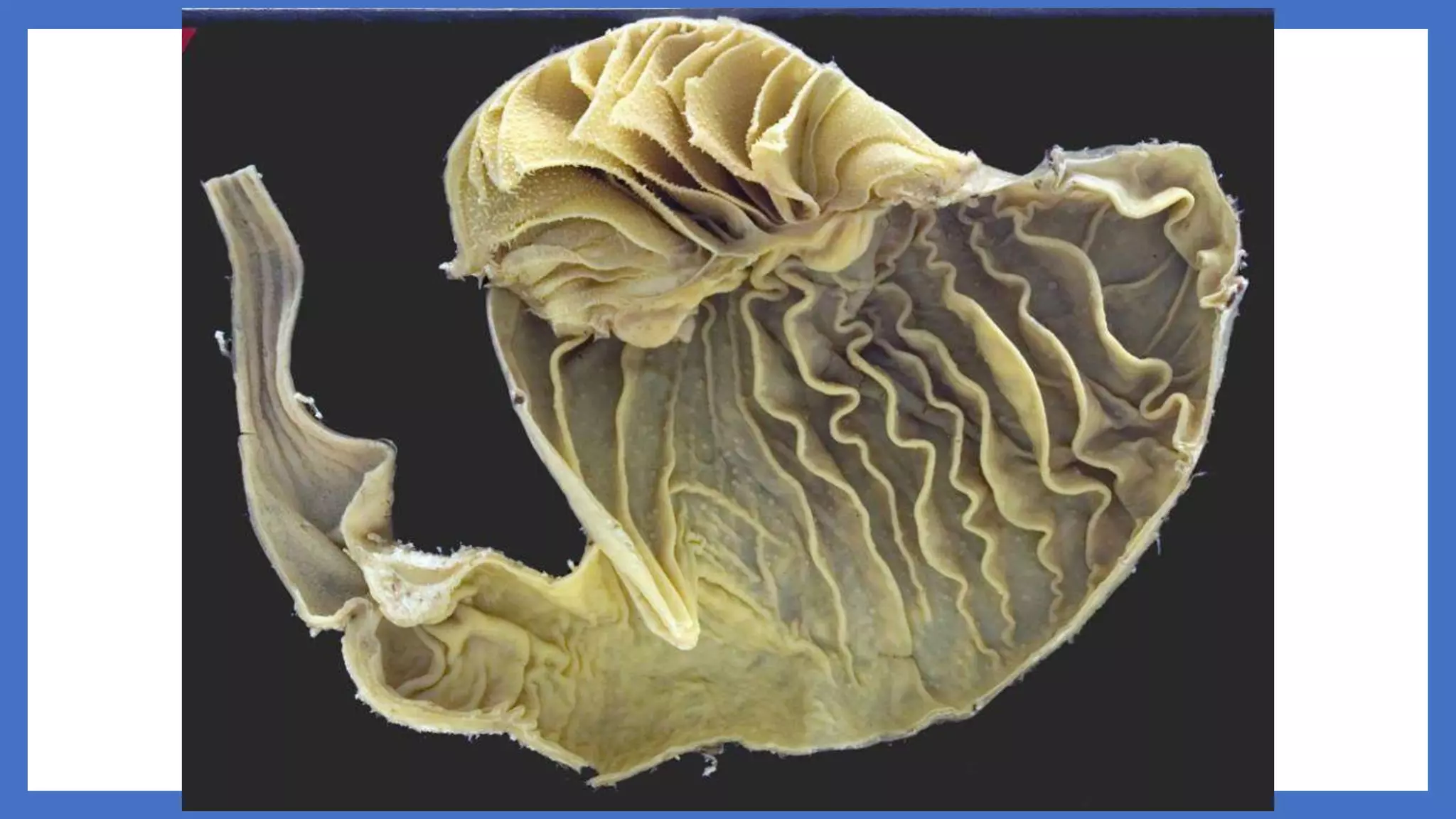 Anatomy of the Ruminant Stomach | PPTX