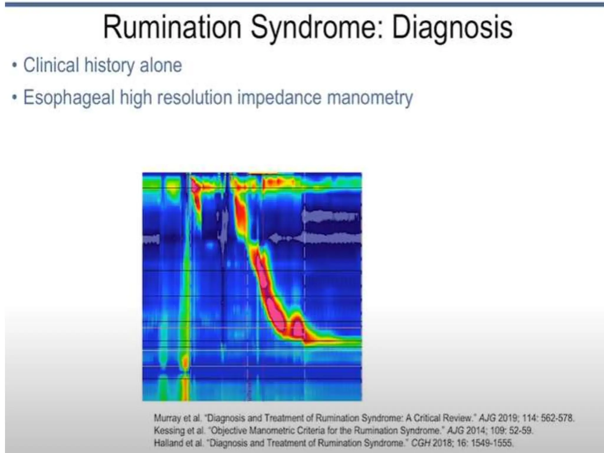 RUMINATION SYNDROME, BELCHING, AEROPHAGIA.pptx | Digestive Disorders | Diseases and Conditions