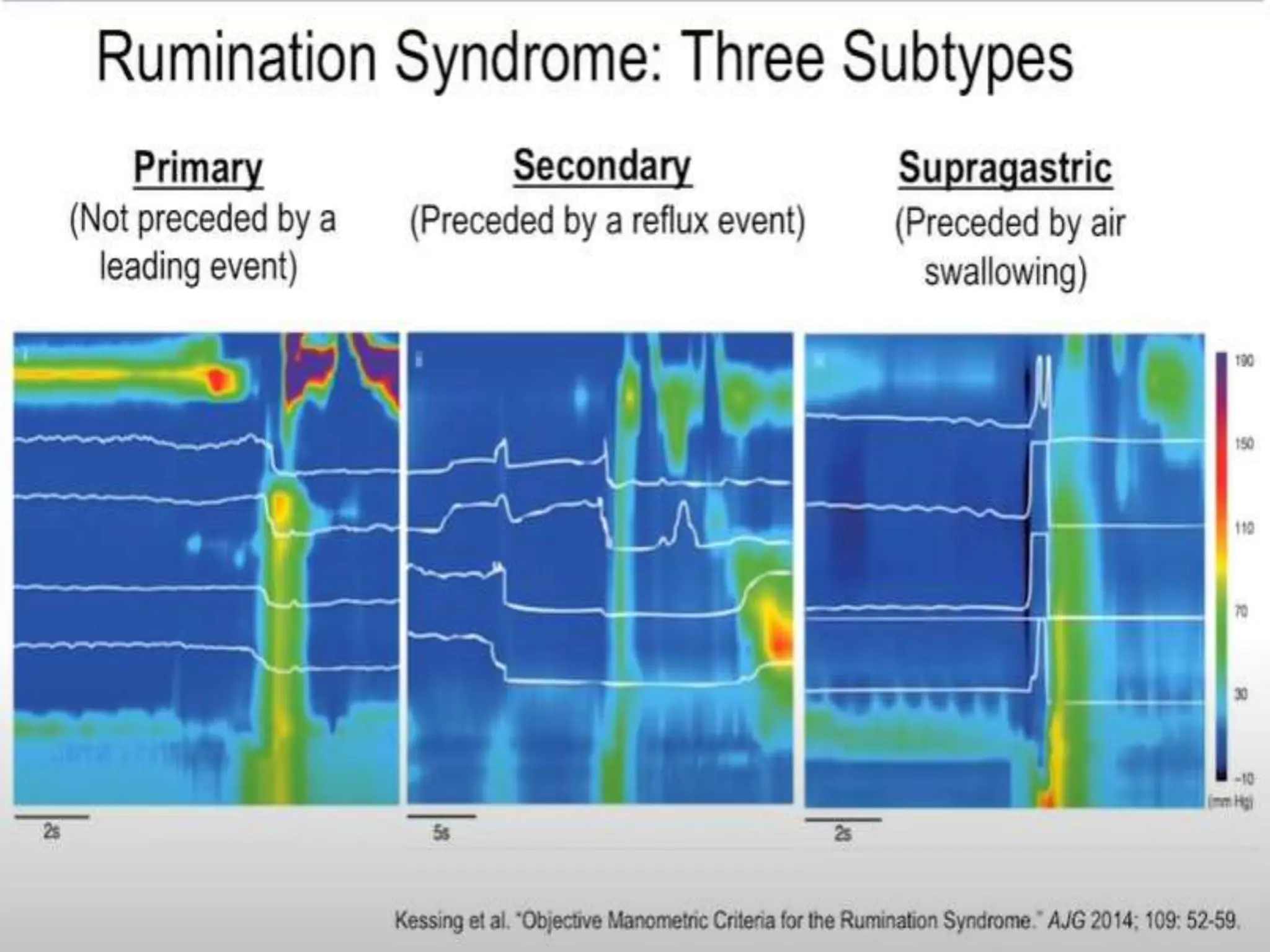 RUMINATION SYNDROME, BELCHING, AEROPHAGIA.pptx | Digestive Disorders | Diseases and Conditions
