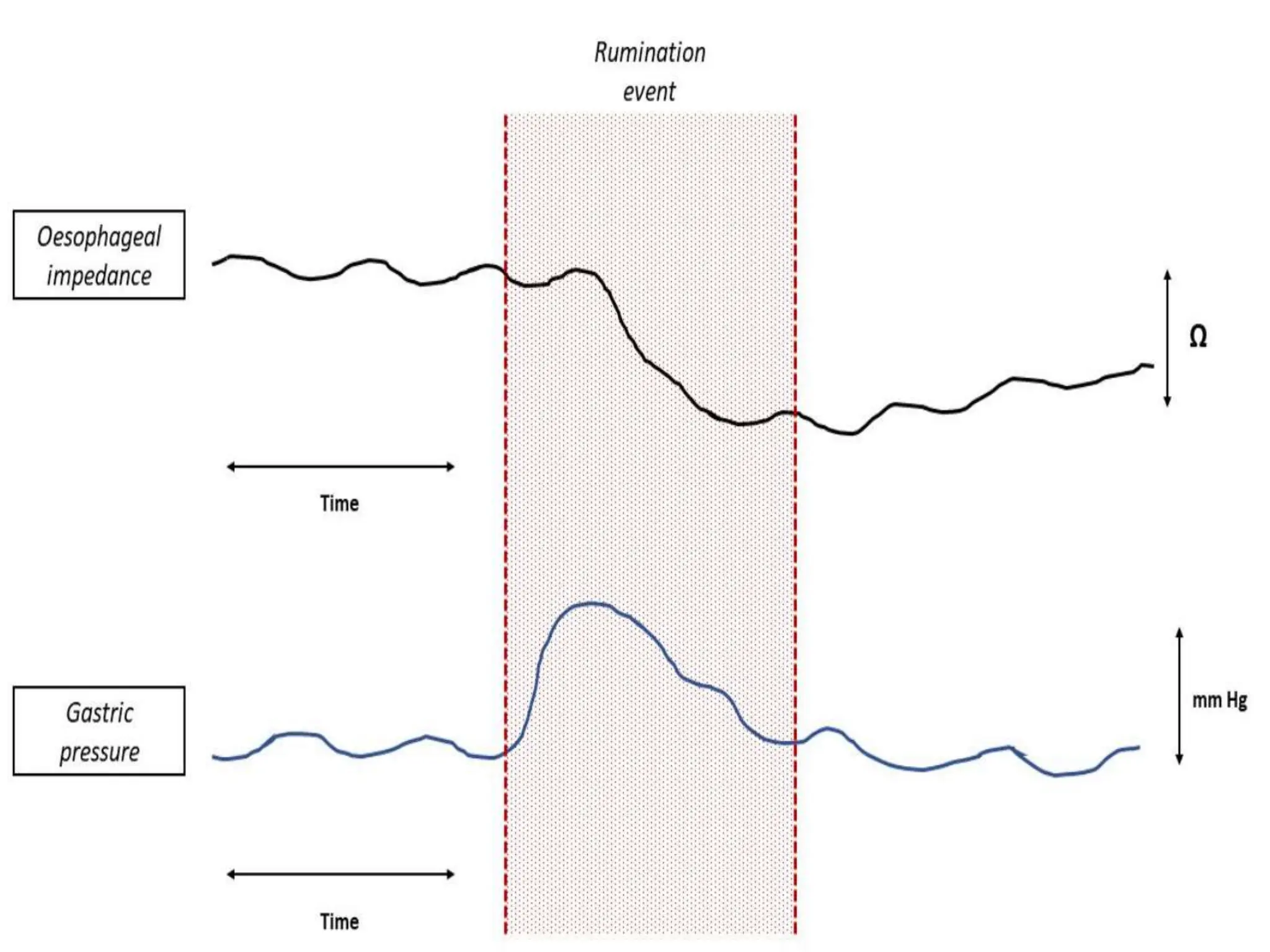 RUMINATION SYNDROME, BELCHING, AEROPHAGIA.pptx | Digestive Disorders | Diseases and Conditions