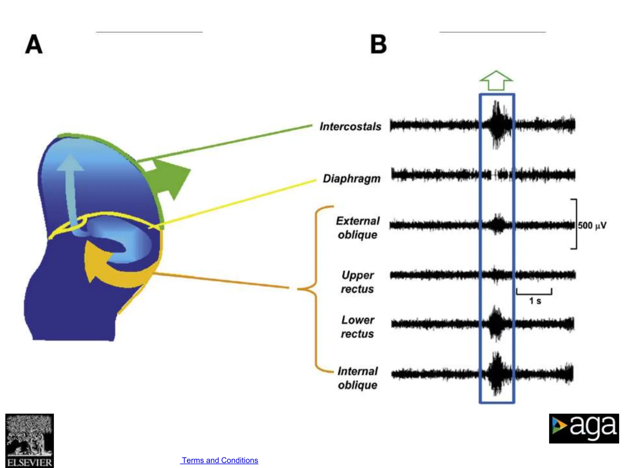 RUMINATION SYNDROME, BELCHING, AEROPHAGIA.pptx | Digestive Disorders | Diseases and Conditions