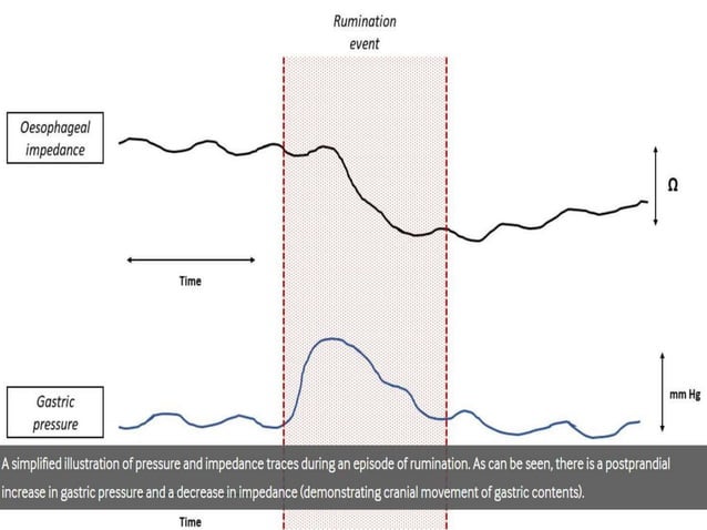 RUMINATION SYNDROME, BELCHING, AEROPHAGIA.pptx | Digestive Disorders | Diseases and Conditions