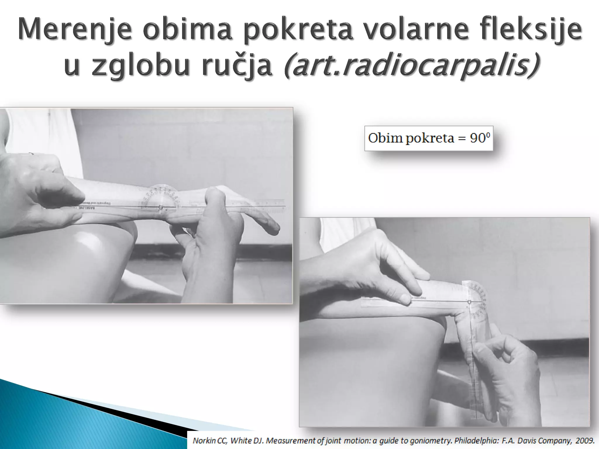Wrist & hand, Ručni zglob i šaka | PDF