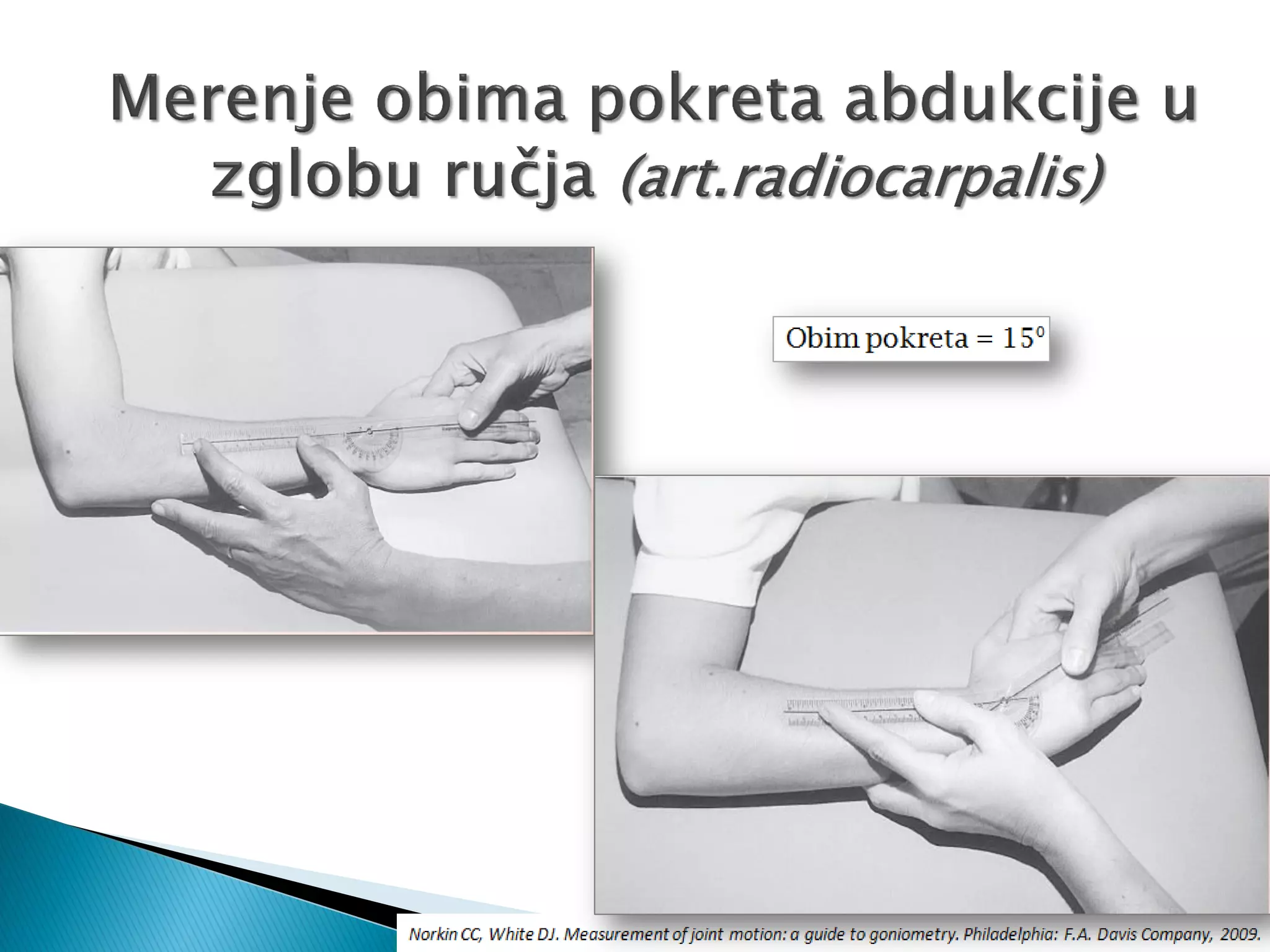 Wrist & hand, Ručni zglob i šaka | PDF