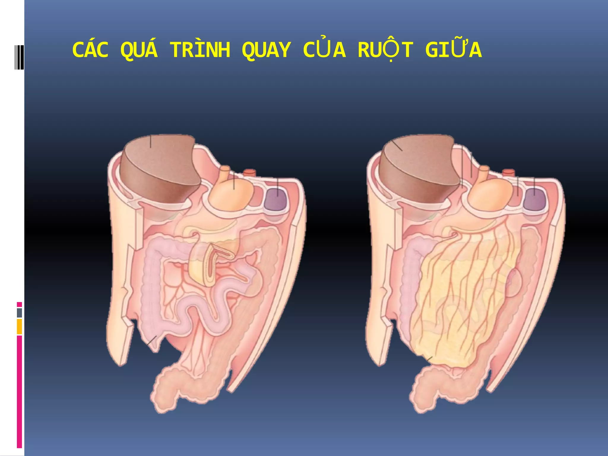 RUỘT NON, RUỘT GIÀ, ĐM MẠCH TREO TRÀNG TRÊN VÀ DƯỚI | PPT