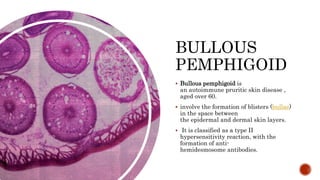 RUPAM PPT -PEMPHIGUS.pptx