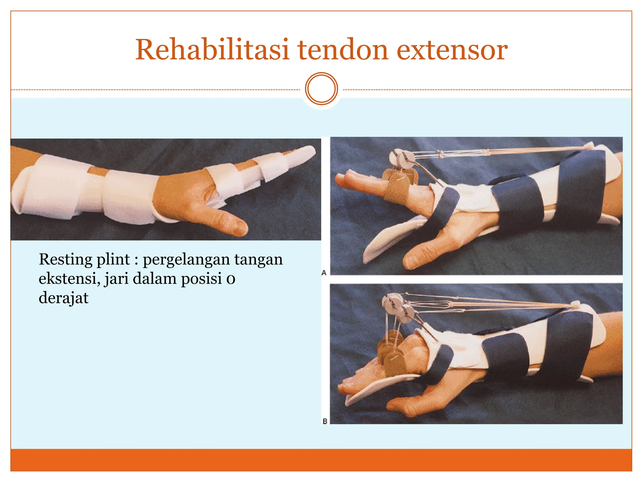 ruptur-tendon-baru_compress tangan | PDF