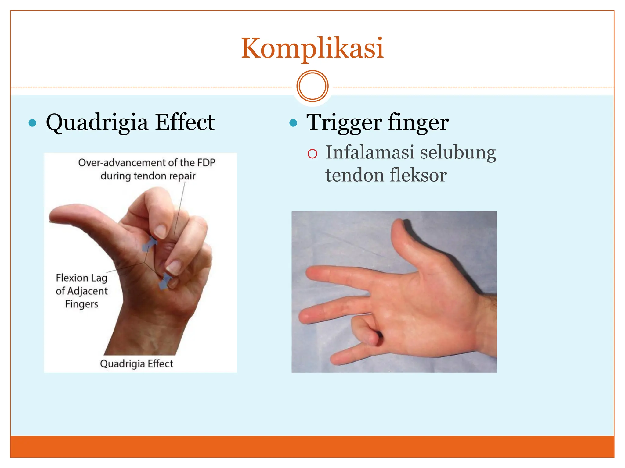 ruptur-tendon-baru_compress tangan | PDF