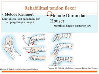 ruptur-tendon-baru_compress tangan | PDF