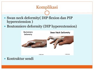 ruptur-tendon-baru_compress tangan | PDF