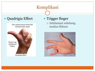 ruptur-tendon-baru_compress tangan | PDF