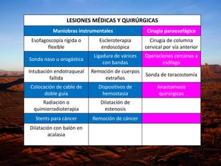 Ruptura esofagica y cuerpos extraños | PPT