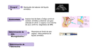 RUPTURA PREMATURA DE MEMBRANAS Y CORIOAMNIONITISpptx | PPTX