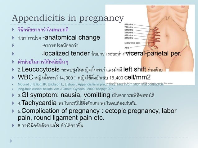Rupture appendicitis | PPTX