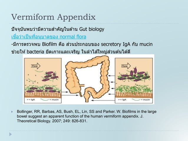 Rupture appendicitis | PPTX
