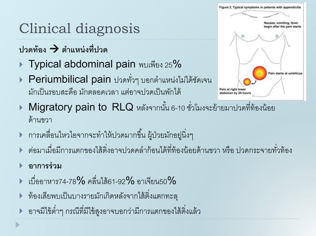 Rupture appendicitis | PPTX