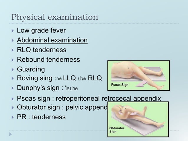 Rupture appendicitis | PPTX
