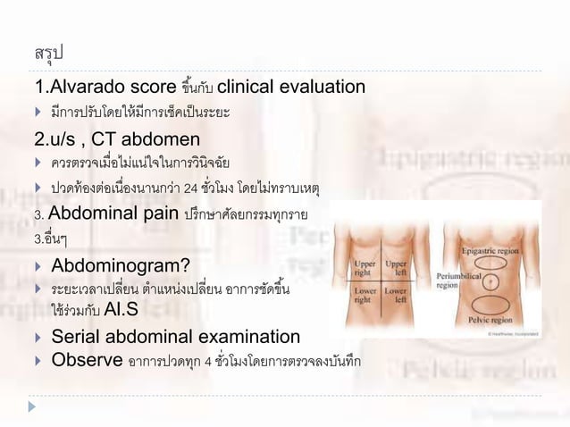 Rupture appendicitis | PPTX