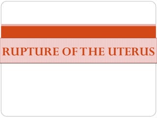 Obstetrics emergency ruptured uterus.ppt