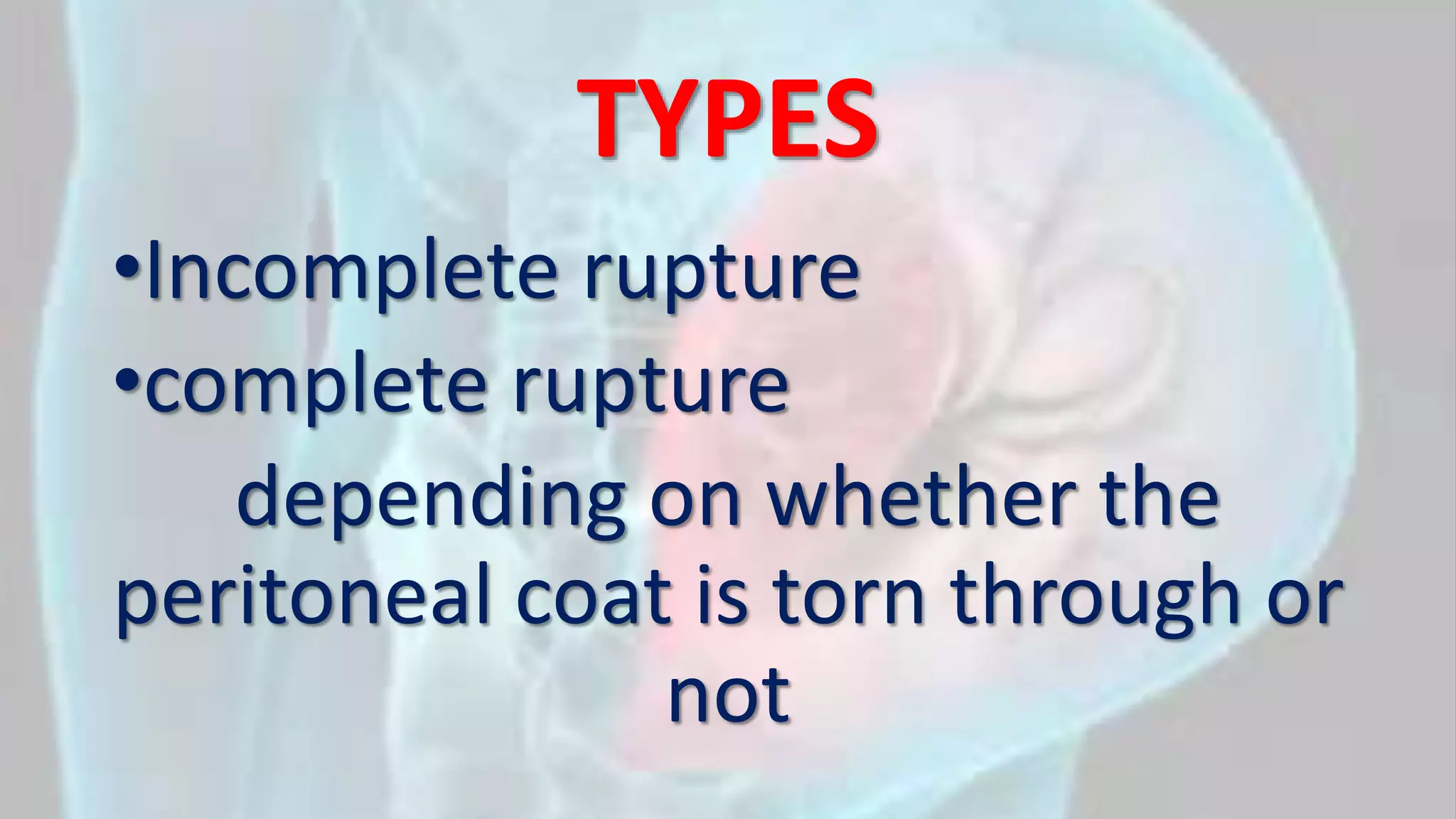 Rupture of the uterus | PPTX