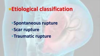 Rupture of the uterus | PPTX