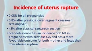 Rupture of the uterus | PPTX