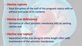 Rupture of the uterus | PPTX