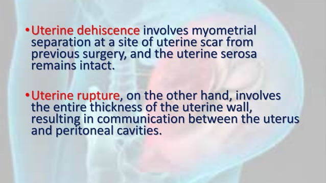 Rupture of the uterus | PPTX