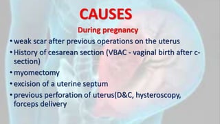Rupture of the uterus | PPTX