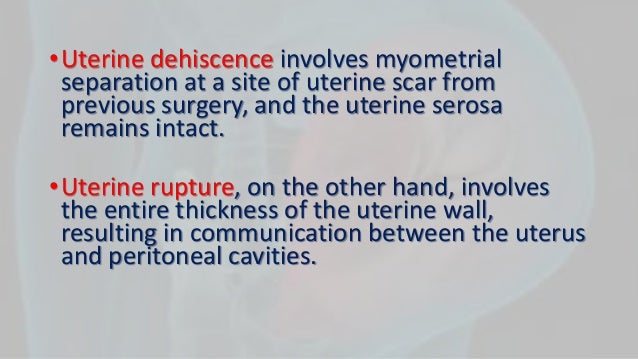 Complete Rupture Of Uterus