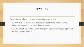 Rupture of the uterus.pptx