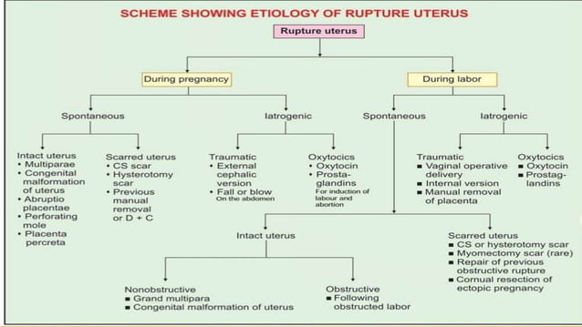 Rupture of the uterus.pptx | Pregnancy | Reproductive Health