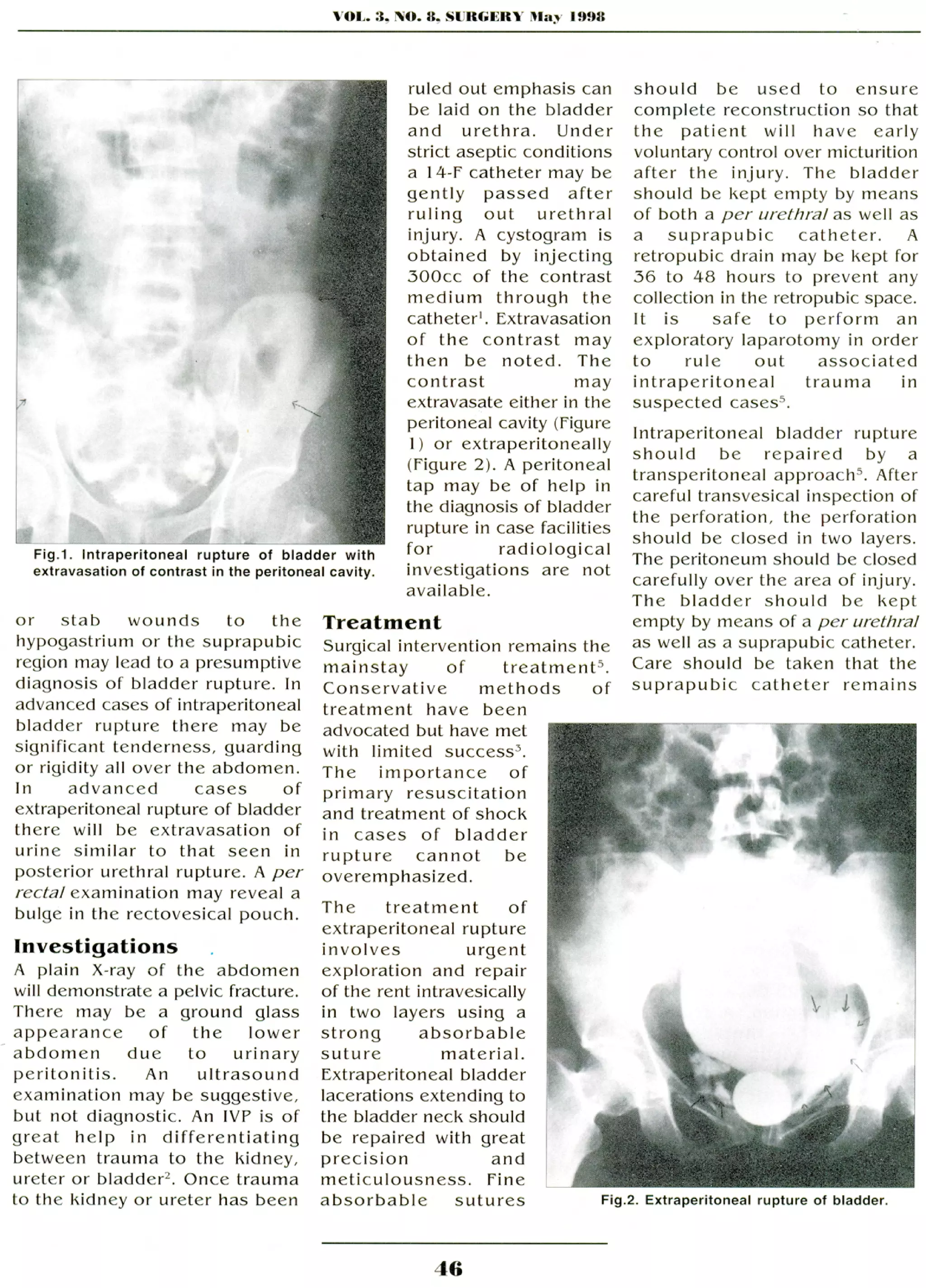 Rupture of the urinary bladder | PDF | Surgery | Medical Health