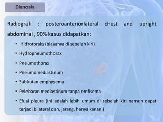 Ruptur esofagus&trauma hepar | PPT