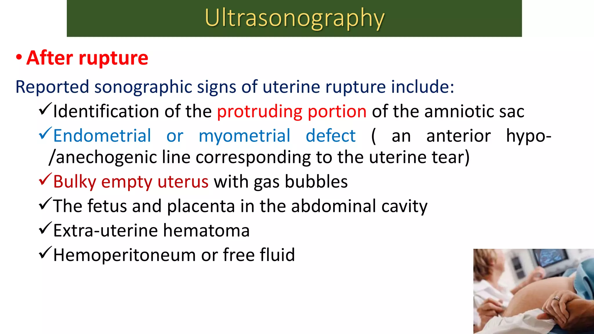 Rupture uterus | PPTX
