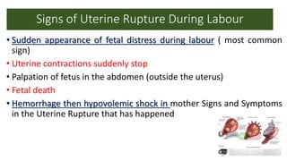 Rupture uterus | PPTX