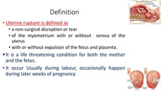 Rupture uterus | PPTX