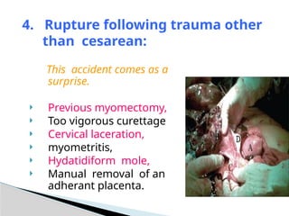 rupture of uterus and nursing management | PPTX