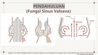 Ruptur Sinus Valsava dfdffdffCTP (1).pptx
