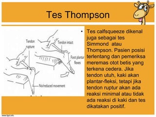 Ruptur_tendo_achilles.pptx biar bisa download ppt ya guys | PPT