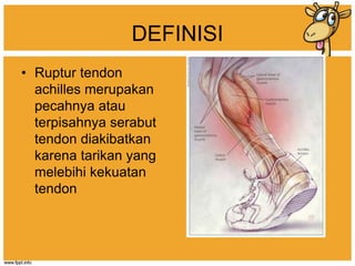 Ruptur_tendo_achilles.pptx biar bisa download ppt ya guys | PPT