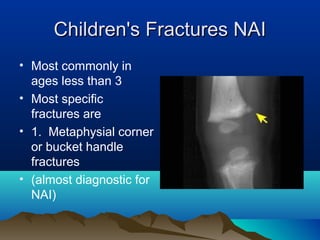 Rural fracture care | PPT