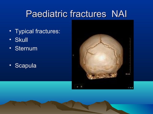 Rural fracture care | PPT