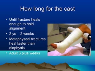 Rural fracture care | PPT
