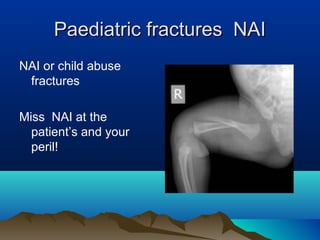 Rural Fracture Care | PPT